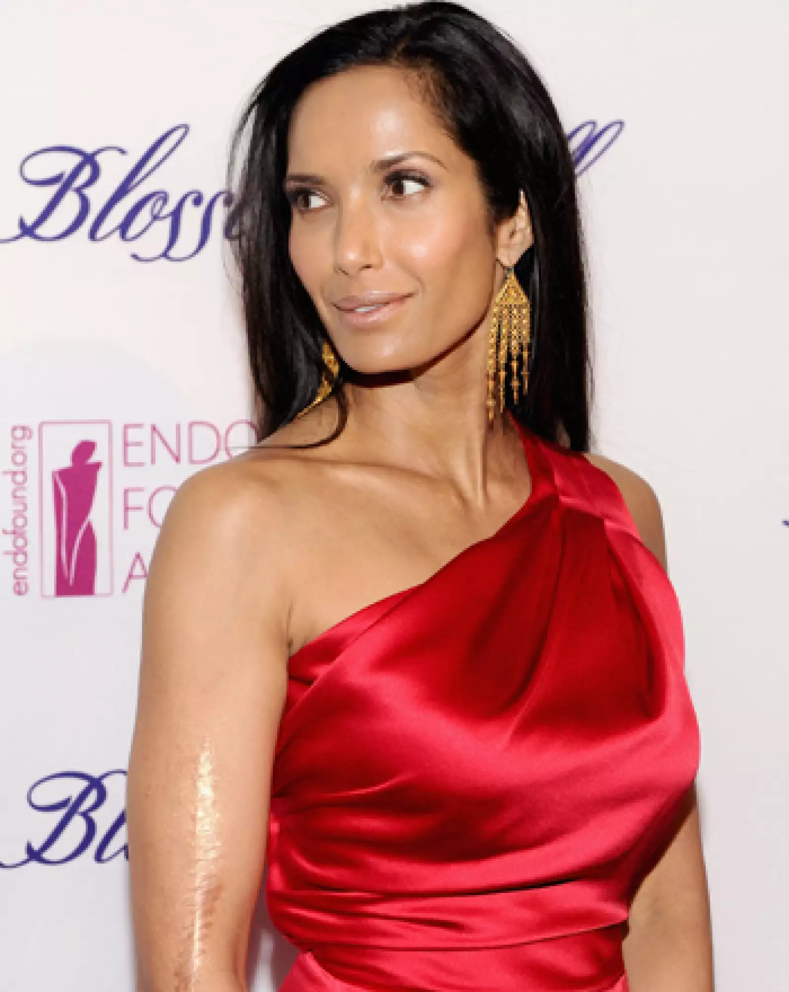 Los defectos físicos de los famosos