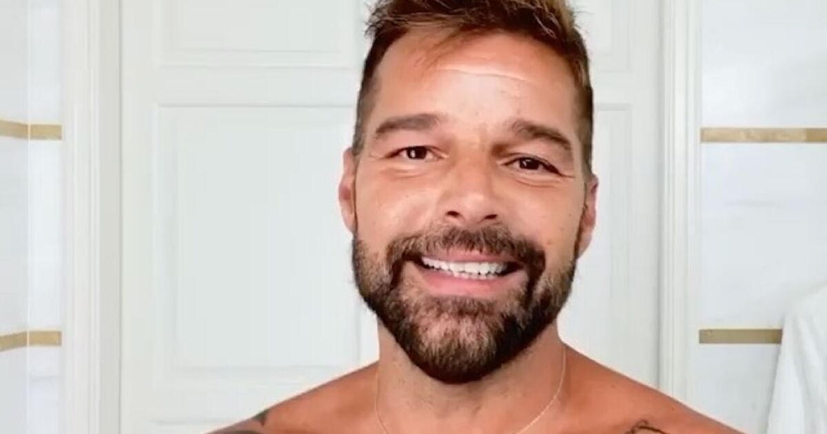 Ricky Martin tuvo reacción alérgica en la cara, asegura su equipo