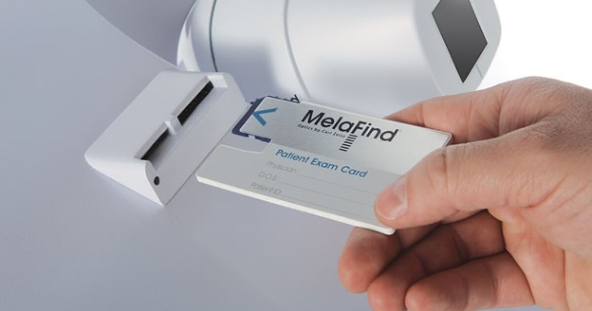 Crean un dispositivo que puede detectar melanoma sin cortar la piel