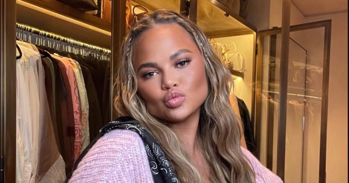 Chrissy Teigen muestra la evolución de su polémico trasplante de cejas