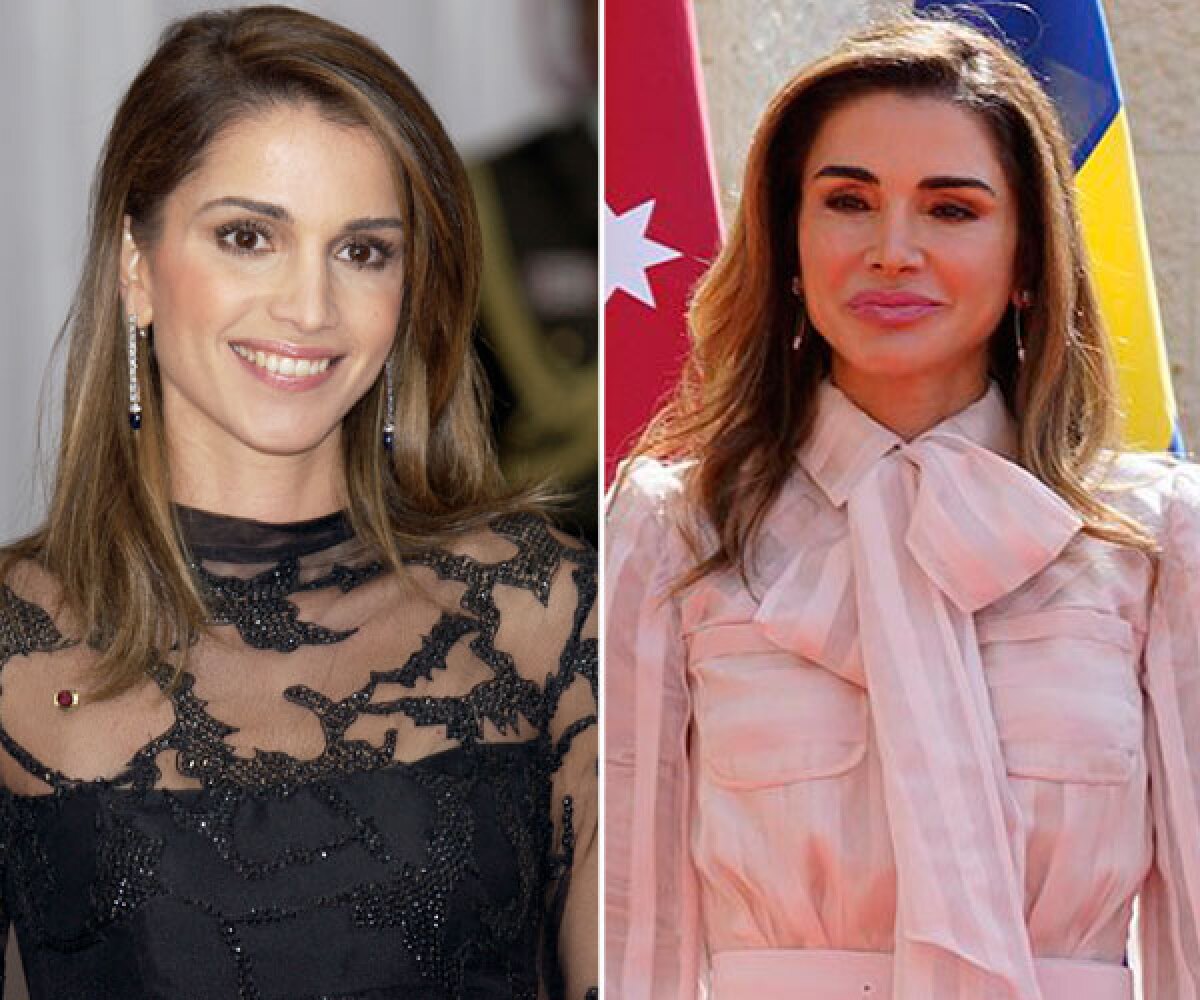 ¿Rania eres tú? La reina de Jordania sorprende con cambio en su rostro