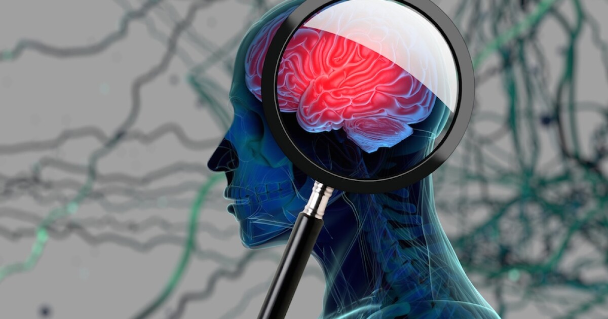 ¿Cómo afecta el estrés a tu cerebro?