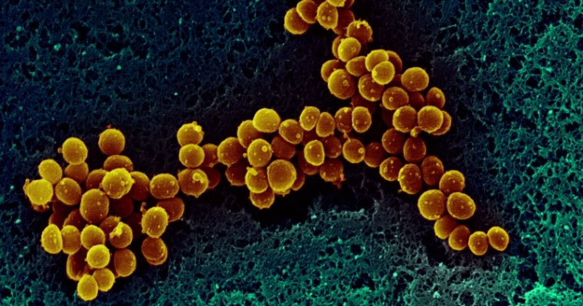 arqueobacterias que son