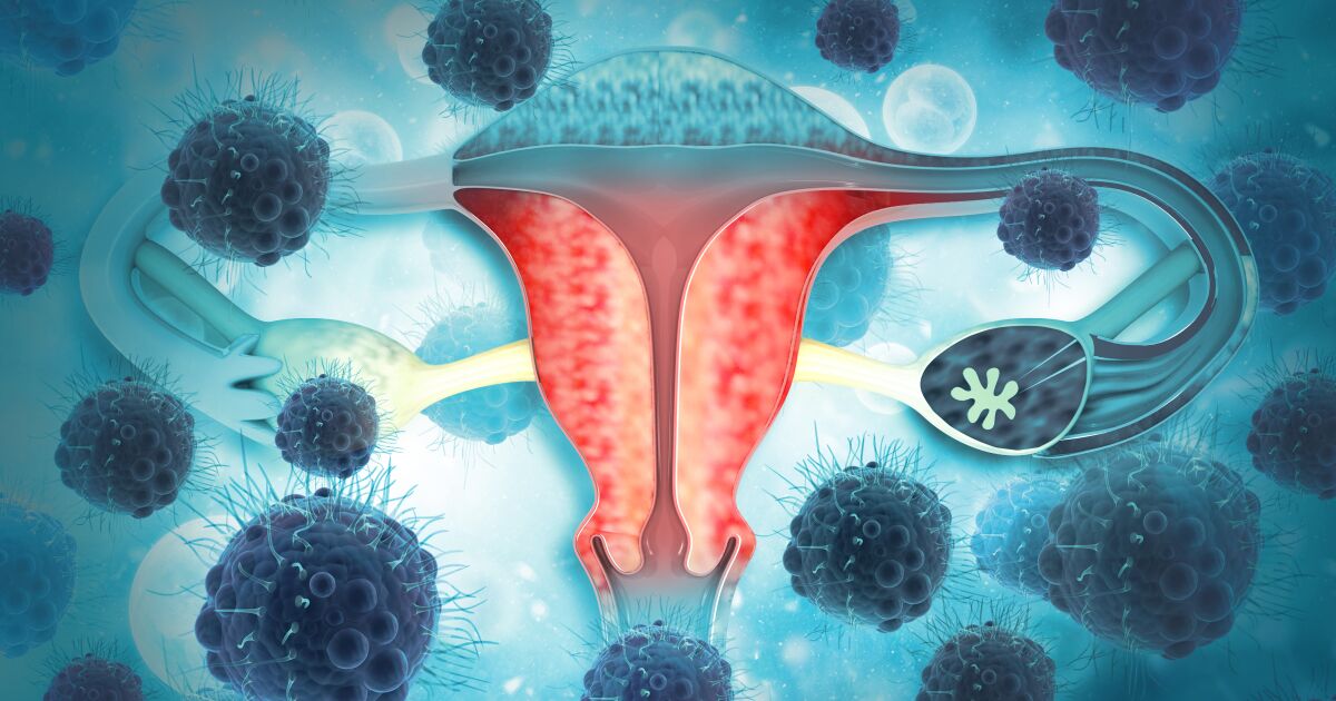 Lo que debes saber del cáncer cervicouterino: síntomas, diagnóstico y ...