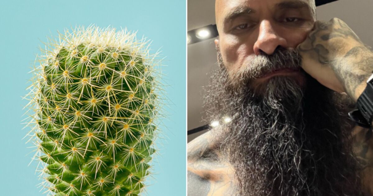 Como Babo: Así son los implantes subcutáneos o pearling en el pene