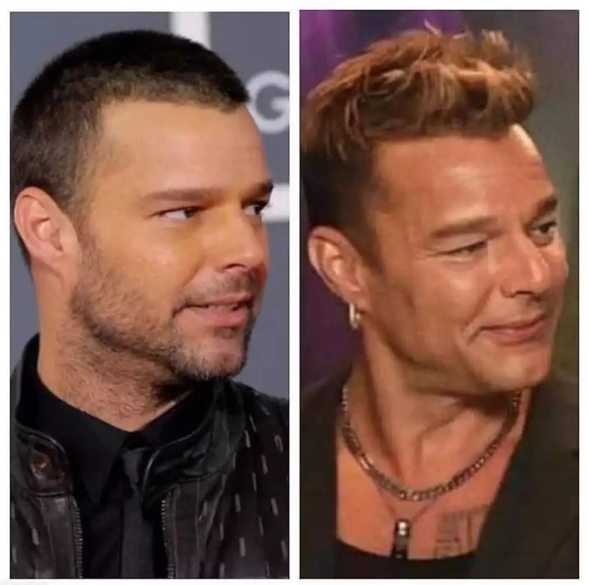 Ricky Martin tuvo reacción alérgica en la cara, asegura su equipo