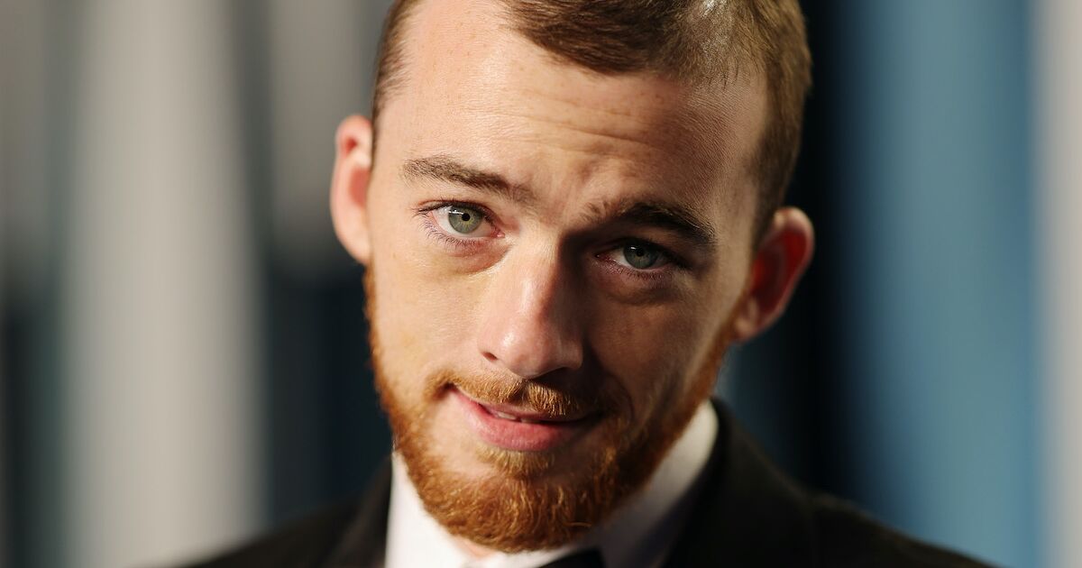 La historia real tras la cicatriz del actor que interpreta a Fez en ...