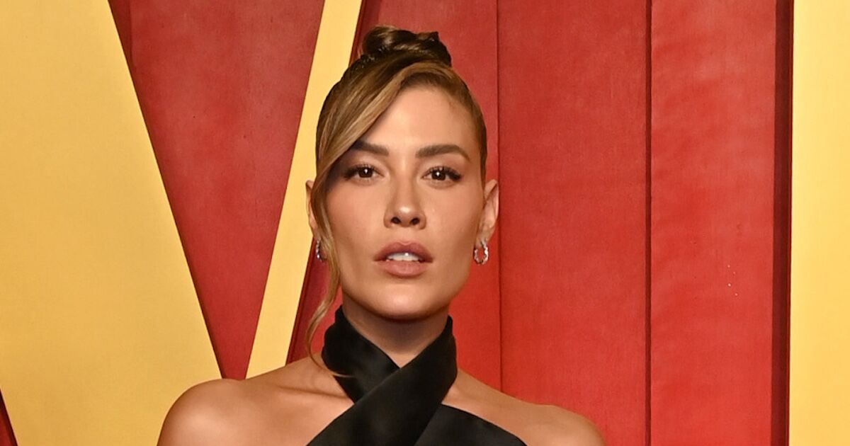 Michelle Salas padece de una enfermedad en la piel