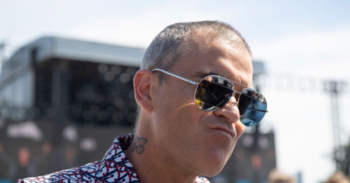 Robbie Williams sabe que llegó el momento de aceptar su calvicie