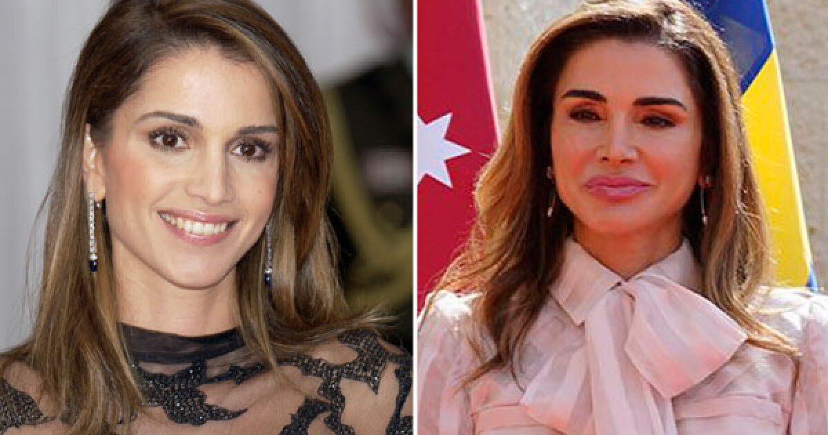 ¿Rania eres tú? La reina de Jordania sorprende con cambio en su rostro