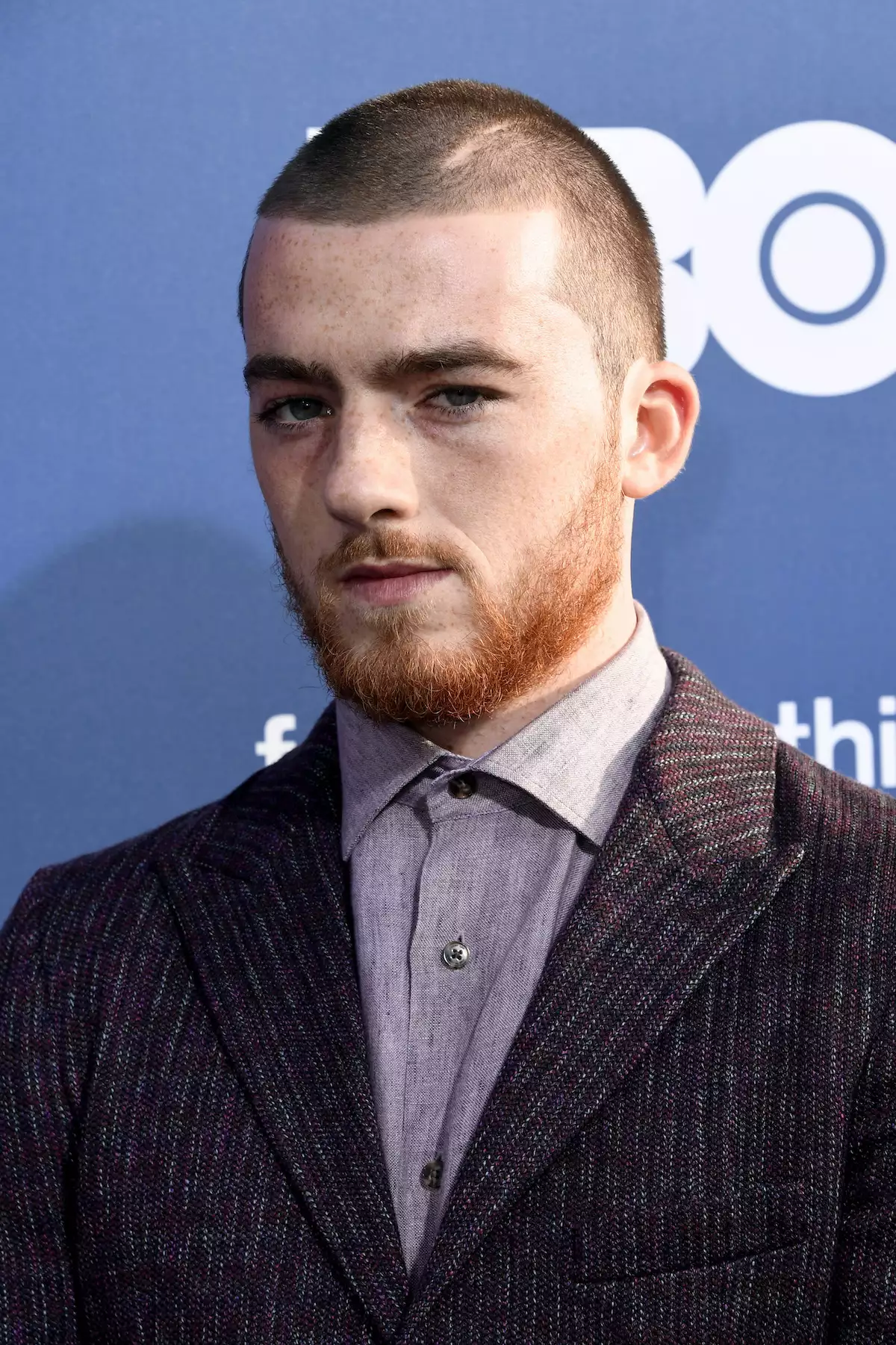 La historia real tras la cicatriz del actor que interpreta a Fez en ...