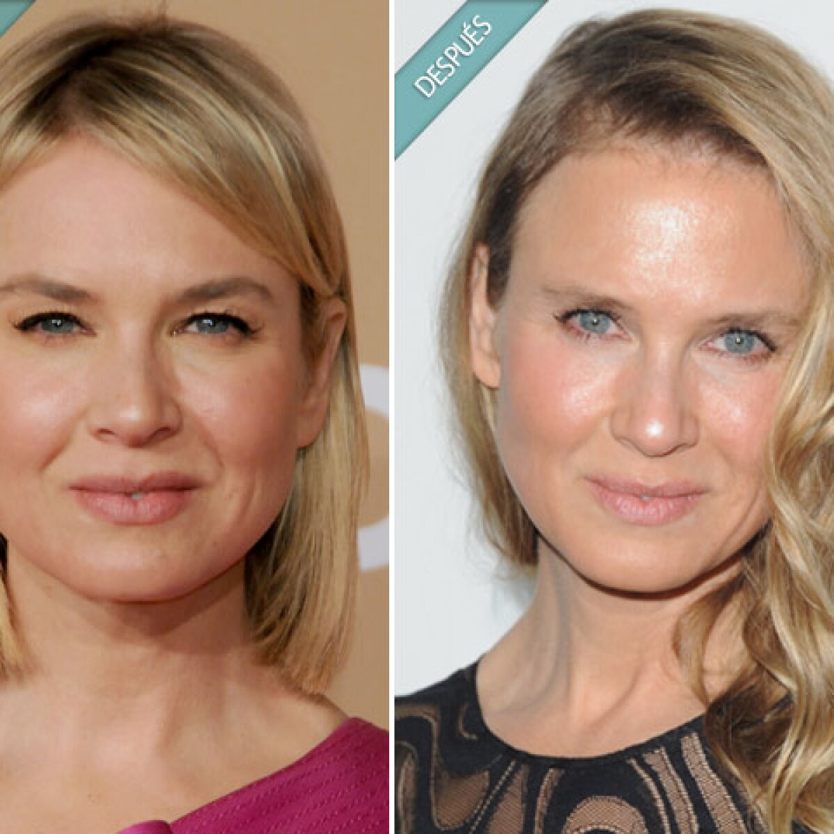 Con esta carta, Reneé Zellweger responde al “trato humillante” por su ...