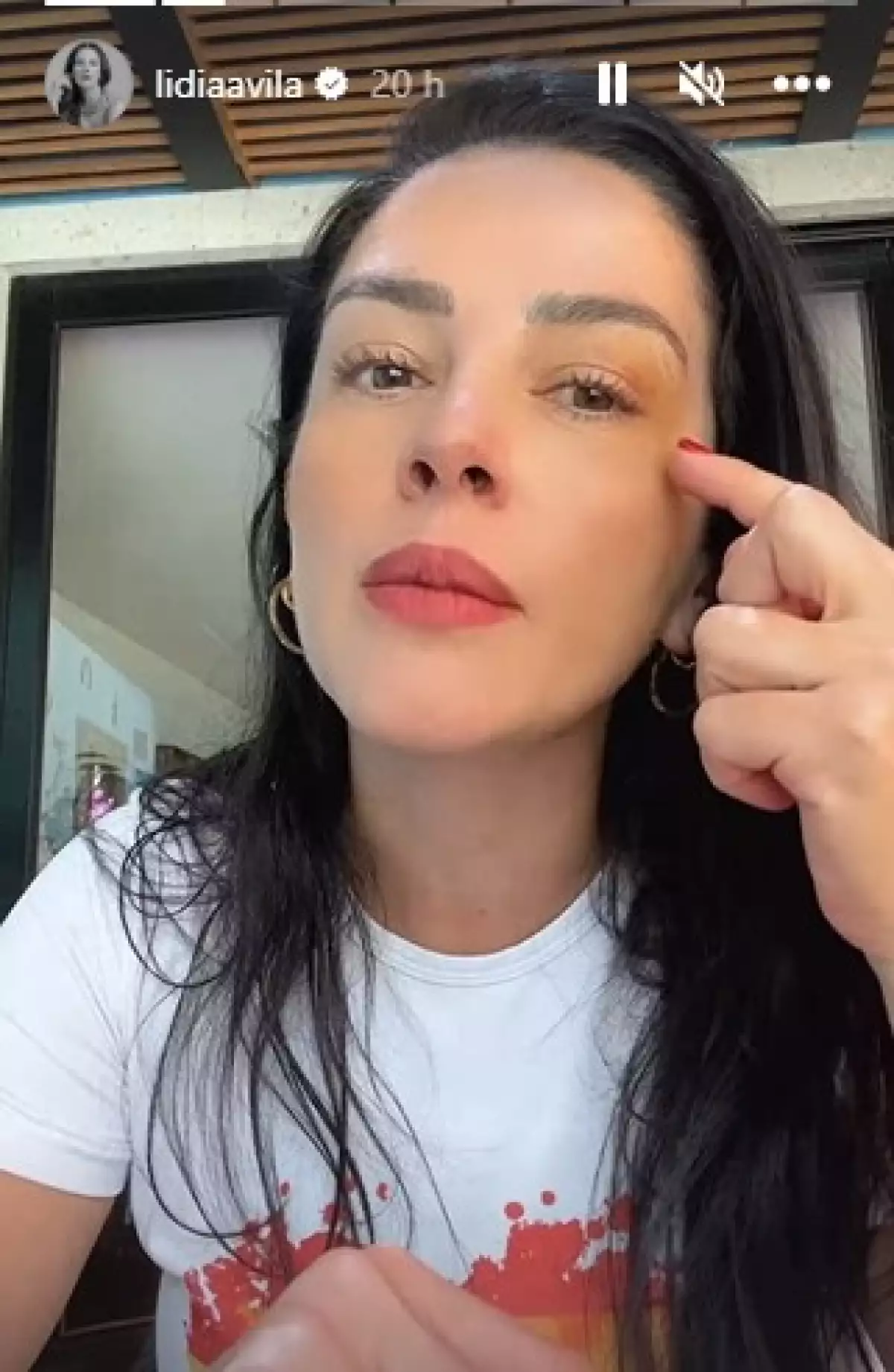 Lidia Ávila sufre accidente tras concierto de OV7 y termina en el hospital