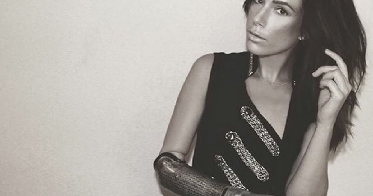 Rebekah Marine, la modelo con brazo biónico que desfilará en NYFW